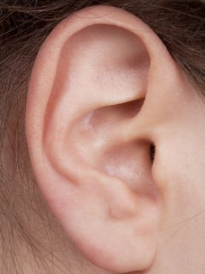 Lobuloplasty in Bexhill, East Sussex